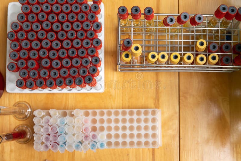 Top View of Blood Samples and Plasma in Tubes on Work Table in a ...