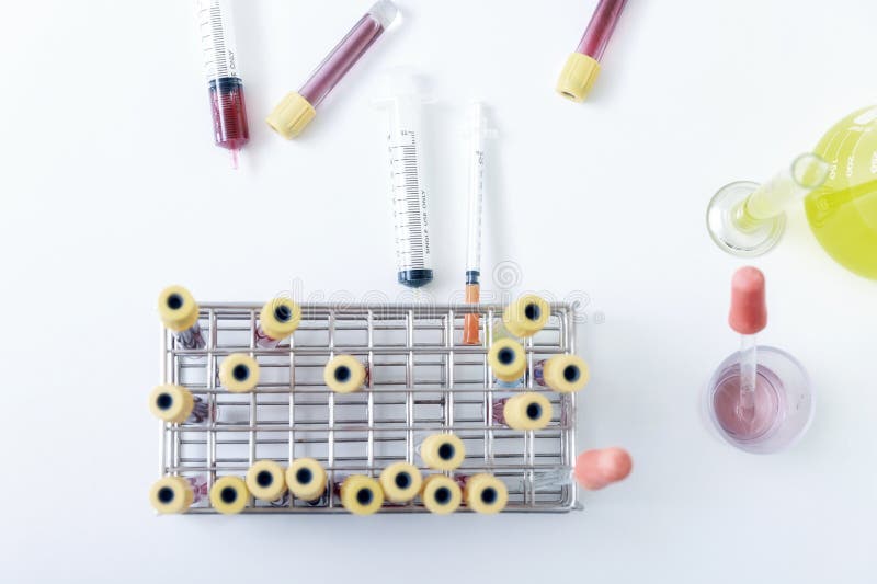Top View of Blood Samples in Tubes and Syringes on Work Table in a ...