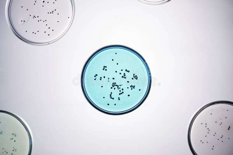 Top View of Petri Dishes with Bacterial Colony in Liquid on Light Table ...