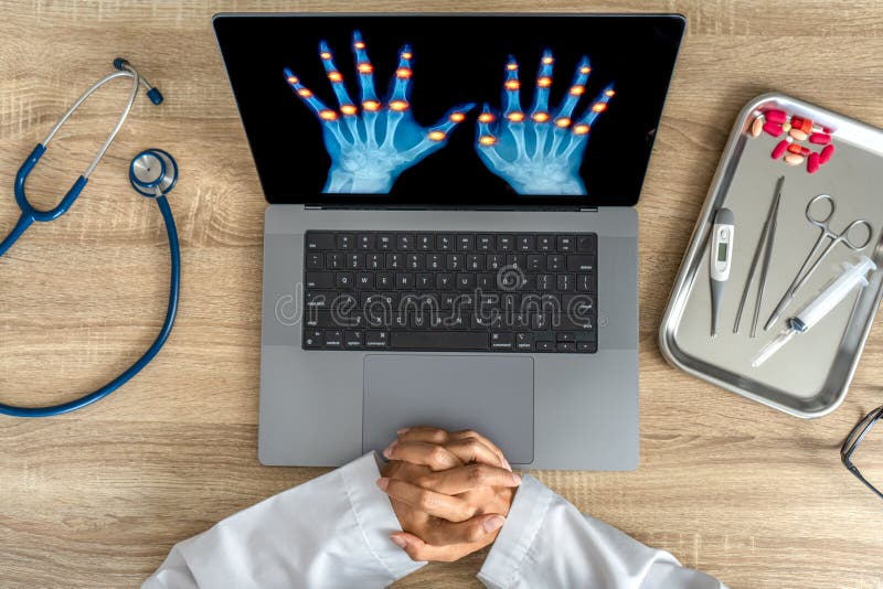 Top View of Doctor Looking X-ray of Hands Editorial Stock Image - Image ...