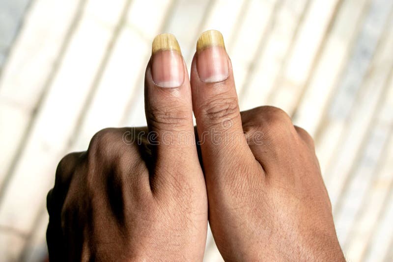 Top View of Man`s Both Thumb Nails are Visible Stock Image - Image of ...