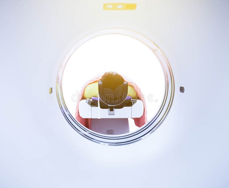 Patient Undergoing CT Scan Machine Scan the Brain. Stock Photo - Image ...