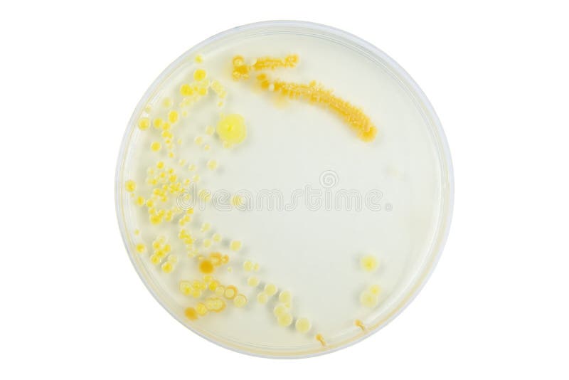 Top View of Petri Dish and Culture Media with Bacteria on White ...
