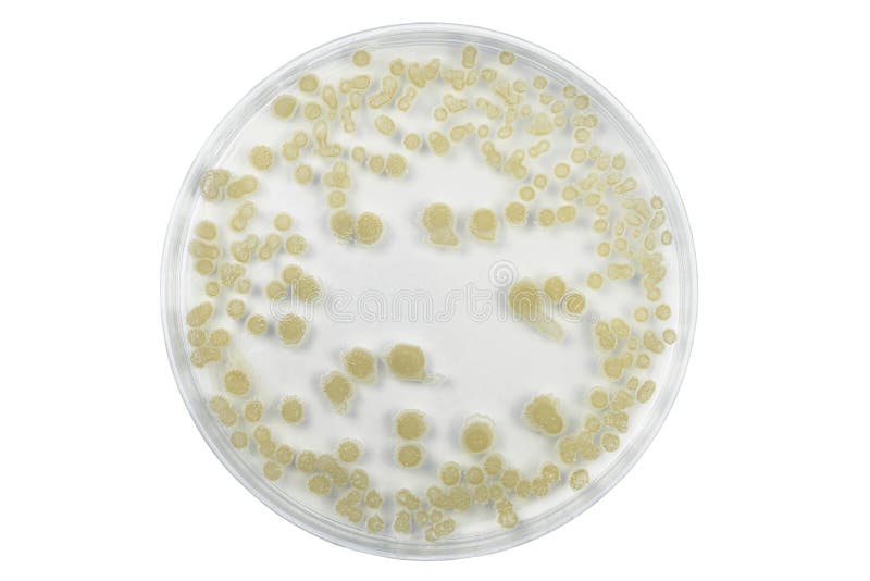 Top View of Petri Dish and Culture Media with Bacteria on White ...