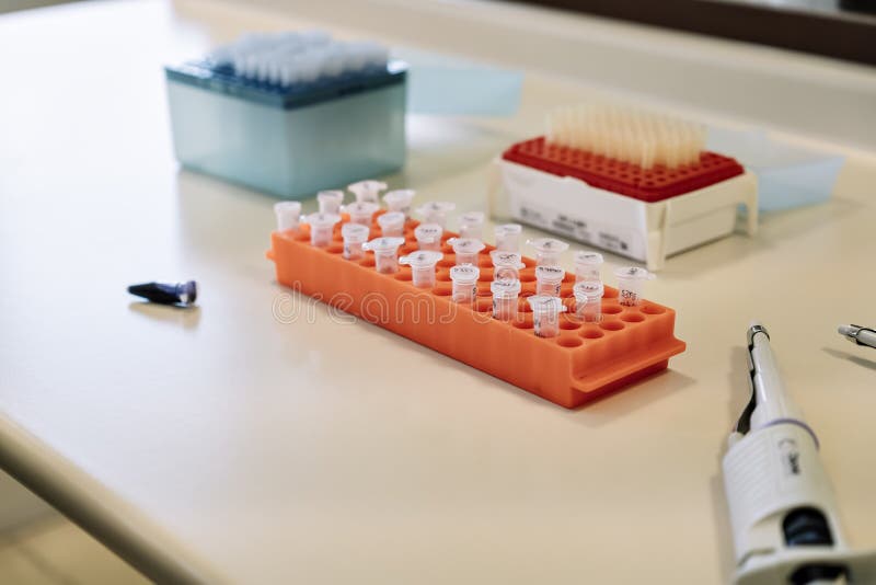 Top View of Pipette and Test Tubes in a Laboratory Stock Photo - Image ...