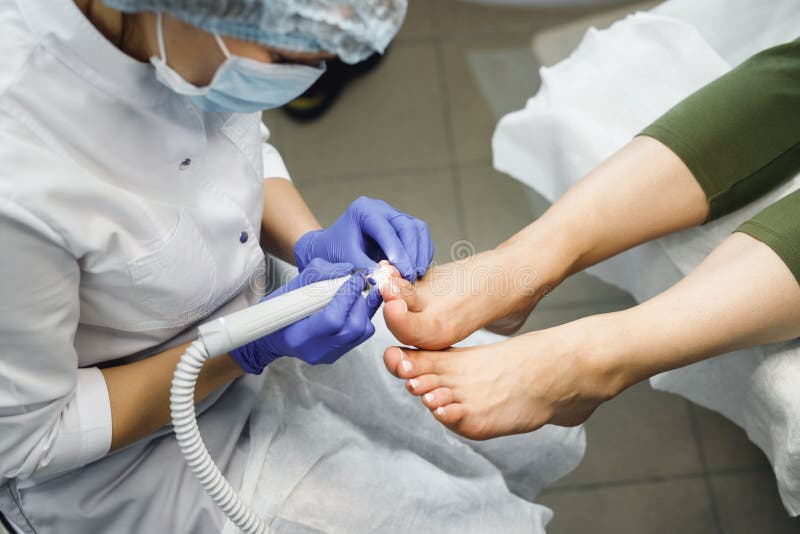 Doctor Podologist Examines The Fungus Of The Nail On The Womans Foot