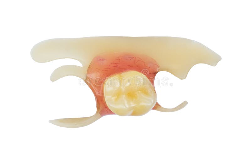 Top View of Single Artificial Denture - False Tooth - Elastic Pr Stock ...
