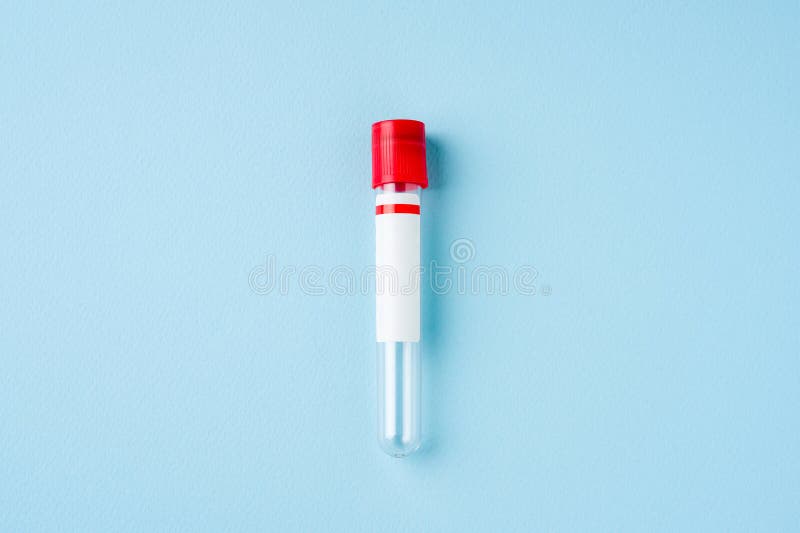 Top View Test Tube Red Cap Blue Background Stock Photos - Free ...