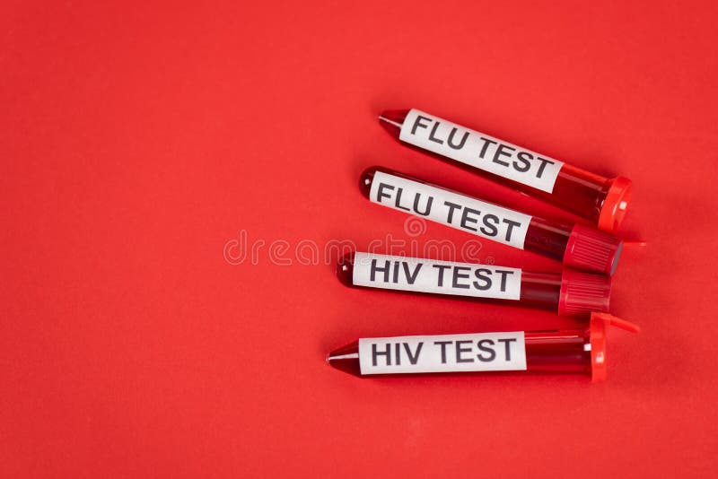 Top View of Test Tubes with Stock Photo - Image of equipment, blood ...