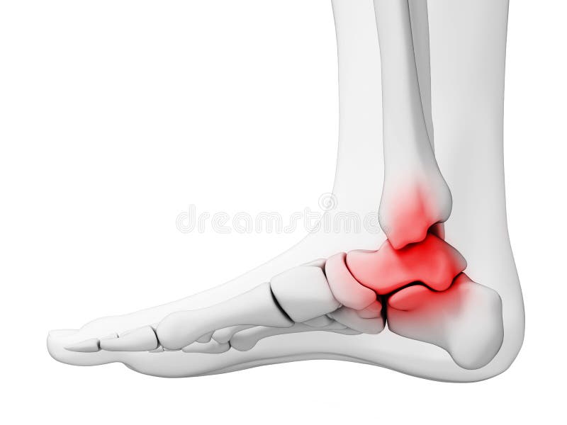 Tornozelo Ilustrações, Vetores E Clipart De Stock – (15,090 Stock ...