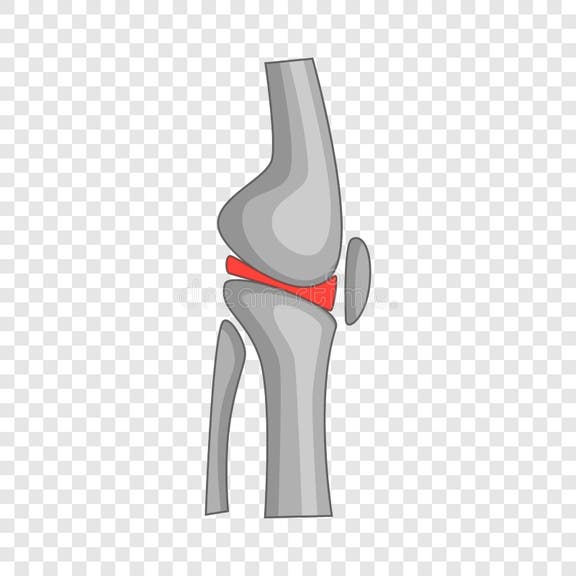Total Knee Replacement Surgery Icon, Cartoon Style Stock Vector ...