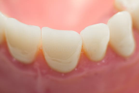 Total prosthesis stock photo. Image of bite, orthodontic - 20368686