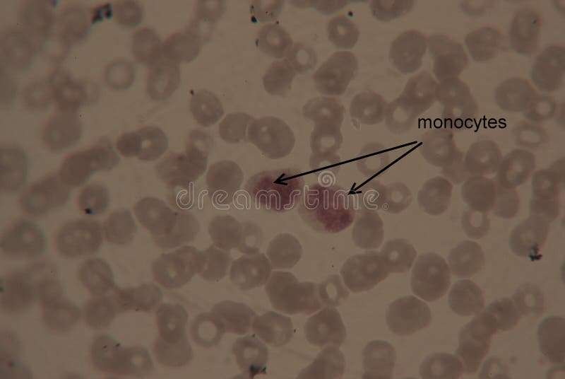 Monocyte Stock Photos - Download 600 Royalty Free Photos