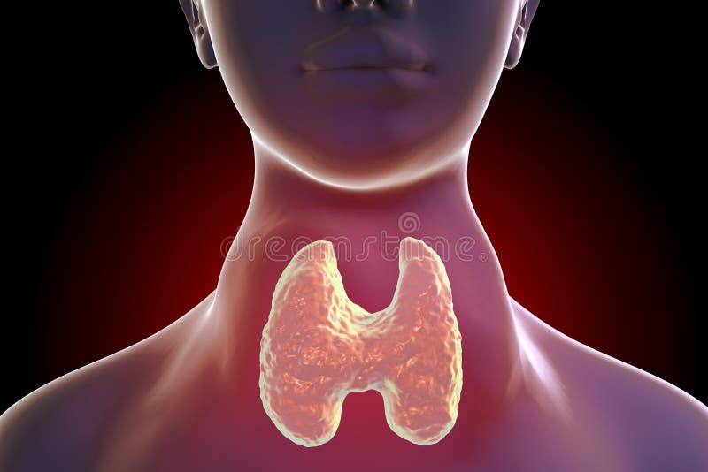 Hyperthyroidism And Hypothyroidism. Female With Signs And Symptoms Of ...