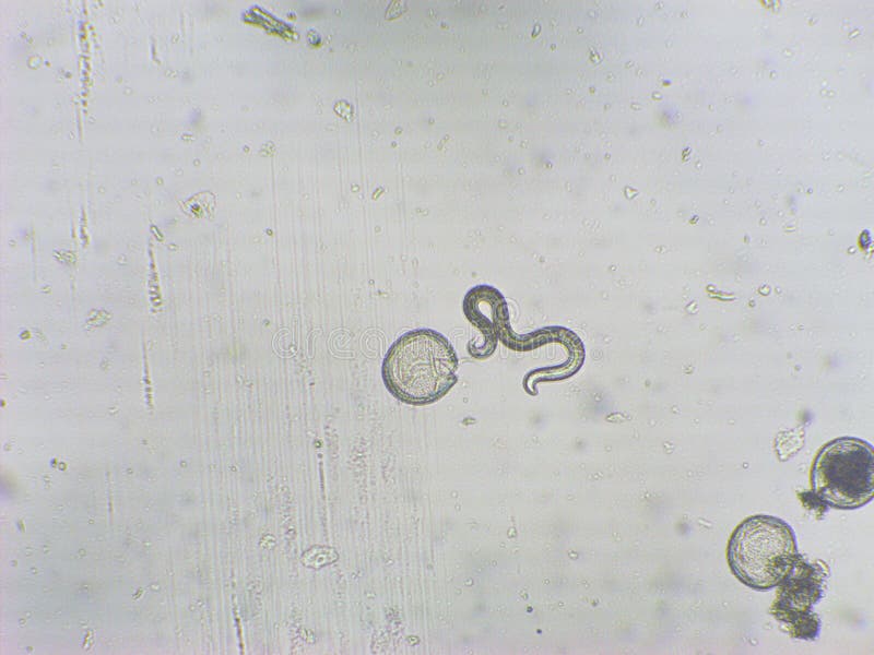 Toxocara Canis Second Stage Larvae Hatch from Eggs Stock Image - Image ...