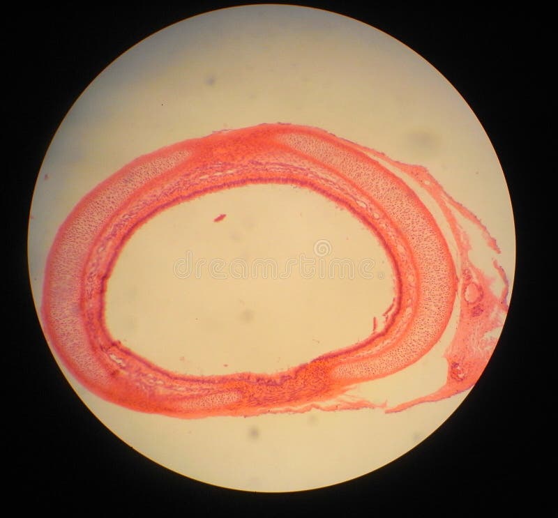 2,059 Traquea Fotos - Libres de Derechos y Gratuitas de Dreamstime