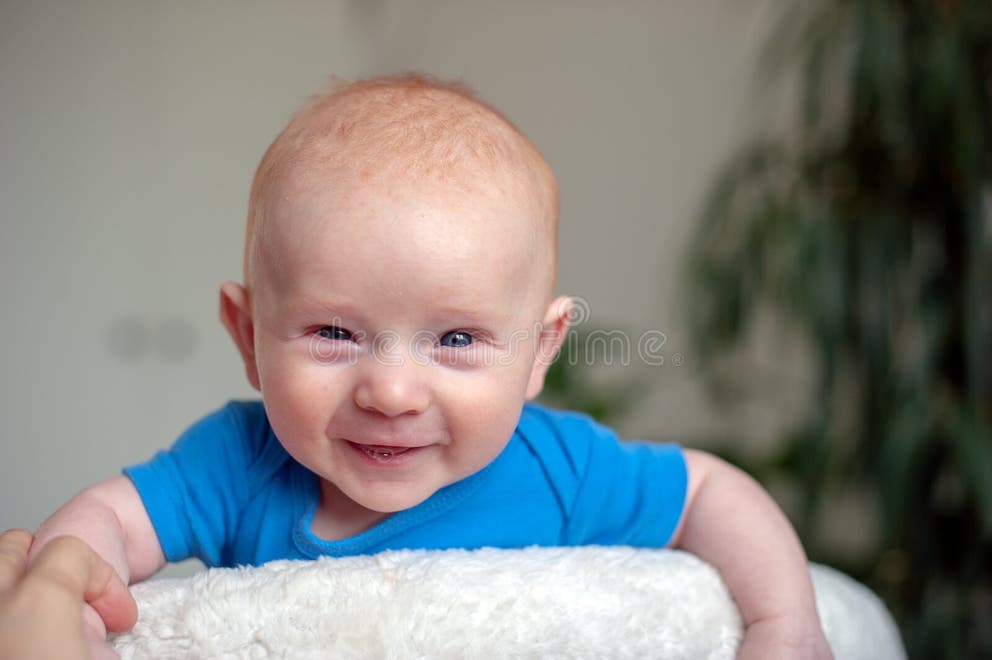 Traces of Diathesis on the Head and Cheeks Stock Photo - Image of ...