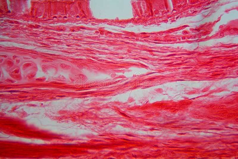 Trachea Cells Under the Microscope Stock Photo - Image of pathology ...