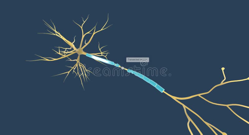 Transected Neurons are Brain Cells that are Damaged Due To Stretching ...