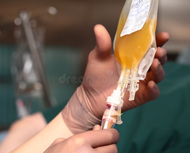 Transfusion De Plasma Humain. Photo stock - Image du urgence, infusé ...