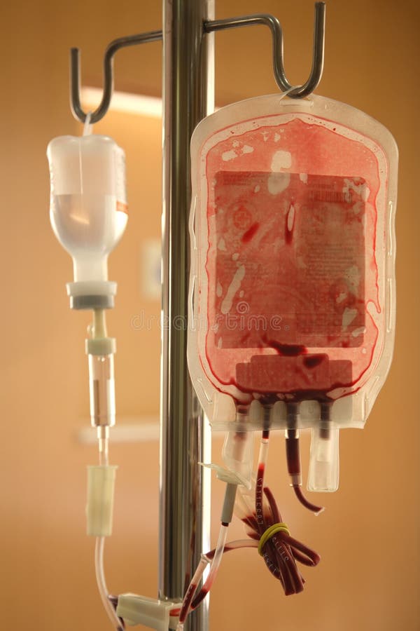Transfusion Sanguine Et Solution Saline IV Image stock - Image du soin ...