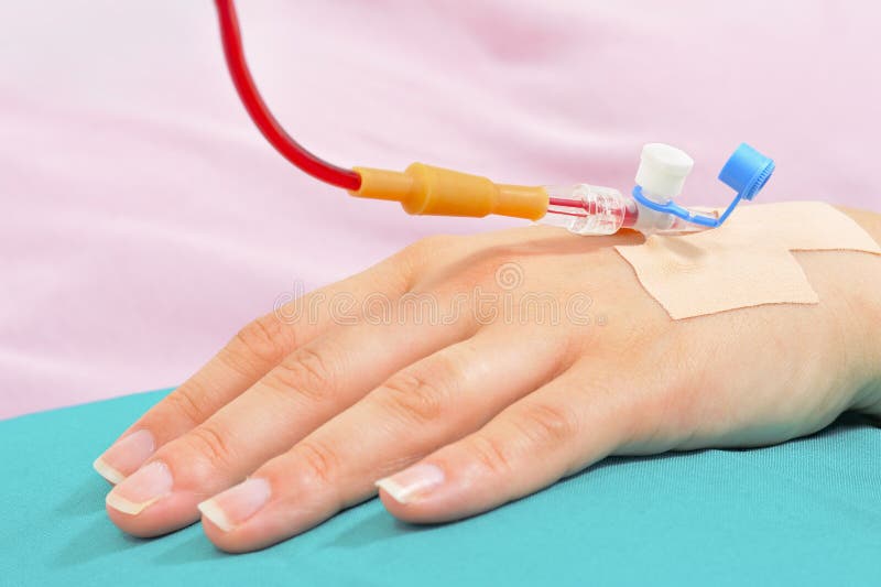 Transfusion sanguine image stock. Image du hôpital, anesthésique - 32902211