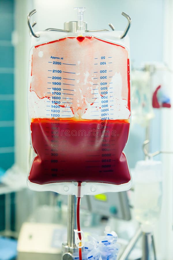 Transfusion Sanguine Humaine Image stock - Image du patient, sauvetage ...