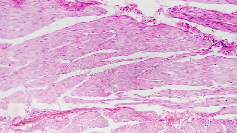 Section of Man Transitional Epithelium Filmed Under Microscope 200x on ...