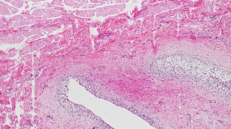 Transitional Epithelium of Man in Section Filmed Under Microscope 40x ...