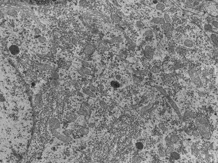 Mitochondria Electron Microscope Free Stock Photos - Free & Royalty ...
