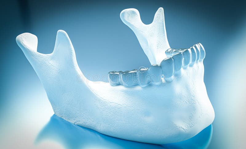 Braces Aligner Stock Illustrations – 264 Braces Aligner Stock ...