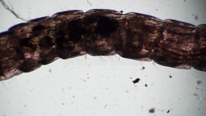 The Transparent Worm is Wiggling and Moving Down in Magnification of ...