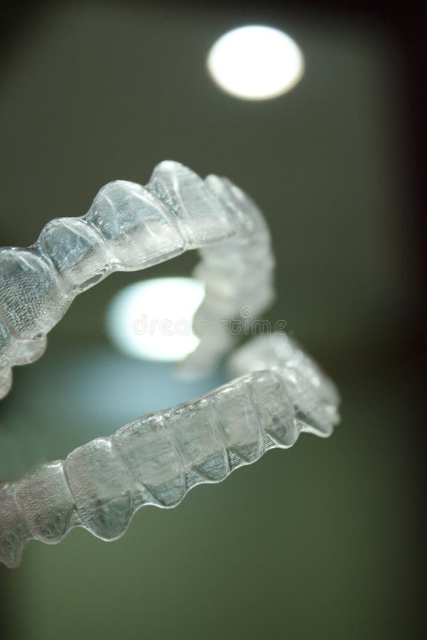 Orthodontics To Correct Alignment of Teeth Stock Image - Image of ...