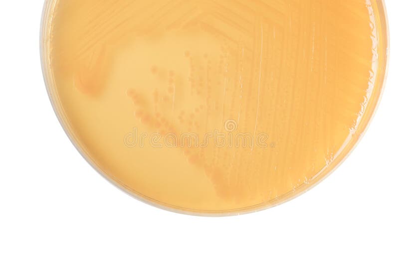 Salmonella Ss Agar