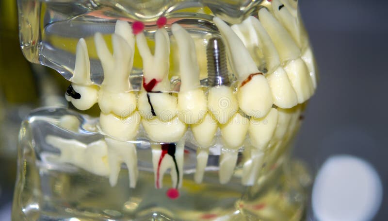 Transparent Model of Human Teeth Stock Photo - Image of healthcare ...