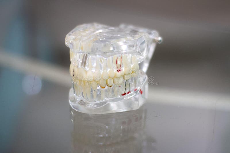 Transparent Mold Showing the Teeth and Their Roots Stock Image - Image ...