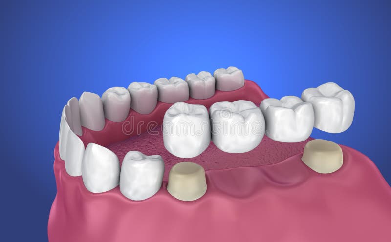 Transparent Teeth. 3d Renderings of Endodontics Inner Structure Stock ...