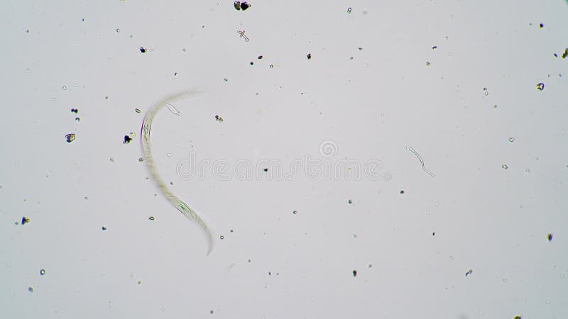 The Transparent Worm is Wiggling and Moving Down in Magnification of ...