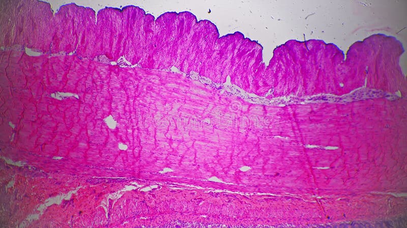 Transversal Section of Large Intestinal Under Microscope 40x for ...
