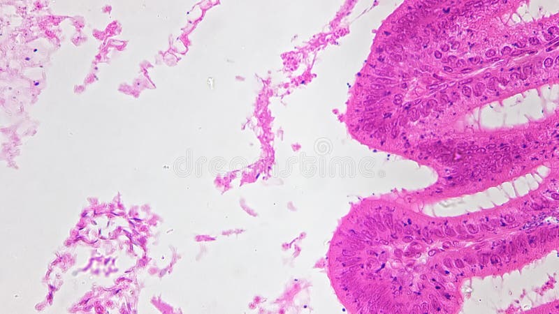 Transversal Section on Pinus Leaf Filmed Under Microscope with 40x ...