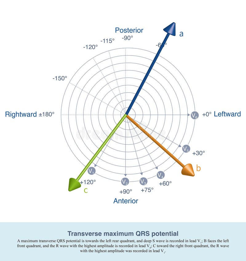 Transverse Lead System Stock Illustrations – 4 Transverse Lead System ...