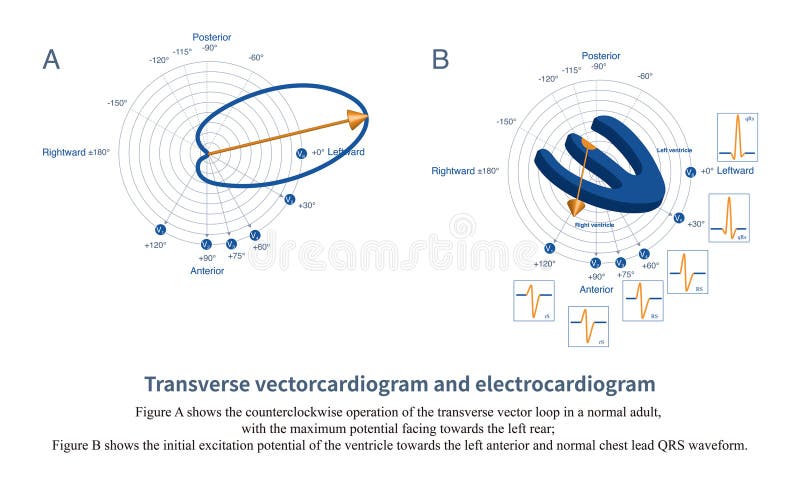 Vectorcardiogram Stock Illustrations – 7 Vectorcardiogram Stock ...