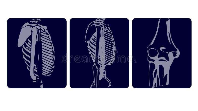 Traumatology. Set of X-rays Isolated on White Background Stock ...