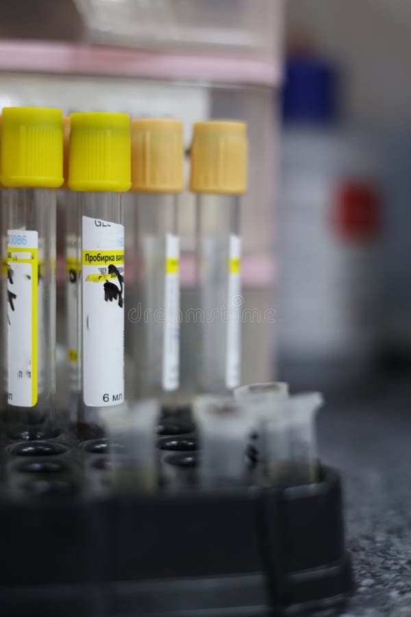 In the Tray are Test Tubes with Blood for Research. in the Laboratory ...