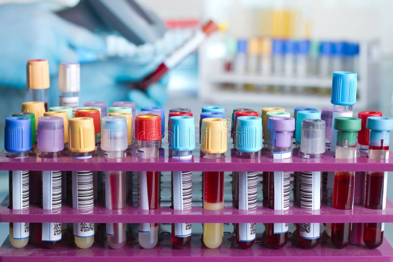 Tray with Tubes with Blood Samples Labeled Stock Photo - Image of group ...