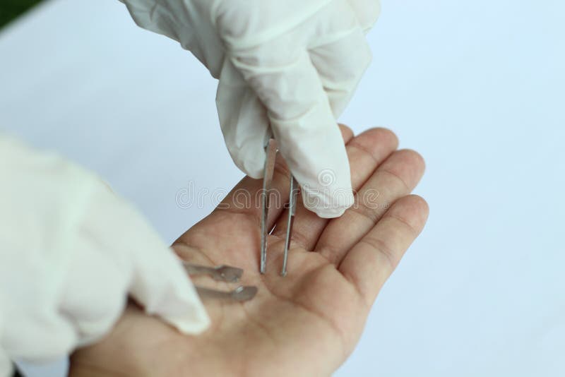 Treatment of the hands stock photo. Image of pincer - 147041270