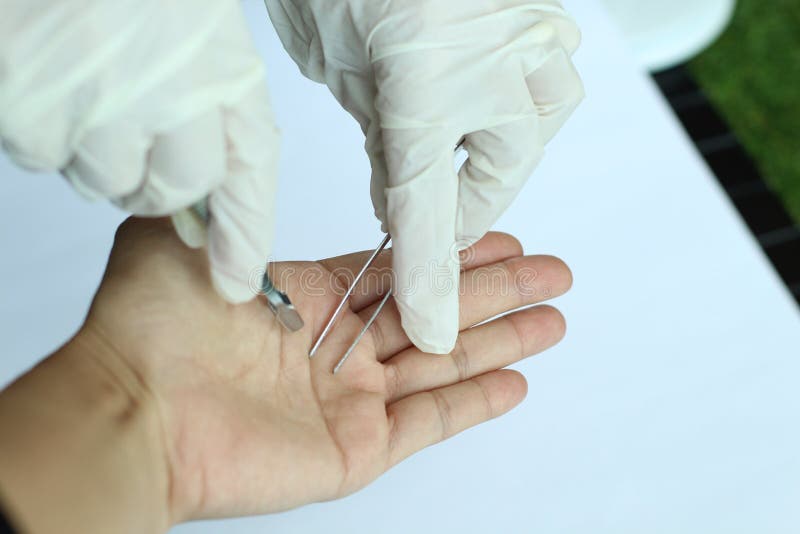 Treatment of the hands stock image. Image of gloves - 147041319