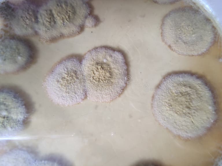 Trichoderma Agar Stock Photos - Free & Royalty-Free Stock Photos from ...