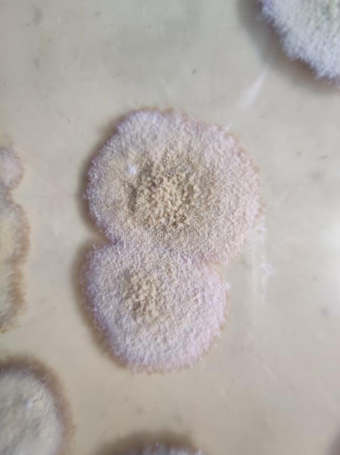 Trichoderma Viridae Young Colonies Stock Photo - Image of dextrose ...