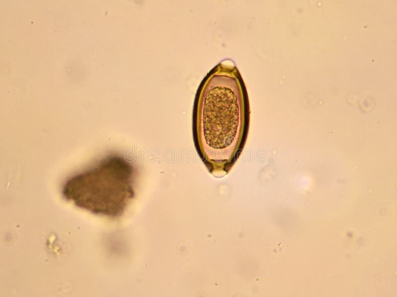 Trichuris-trichiura stockbild. Bild von mikrobiologie - 70356763